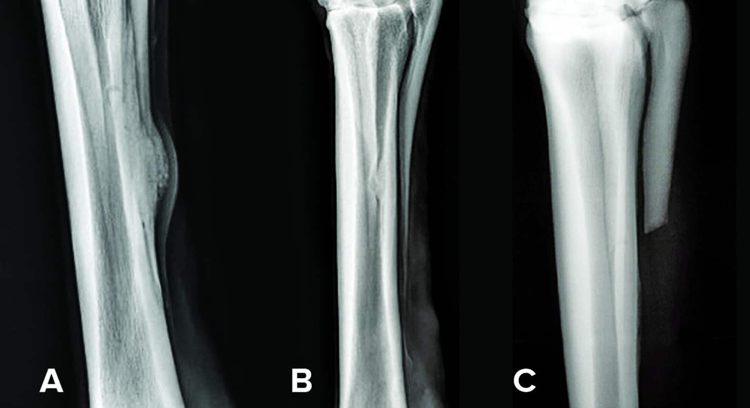 Vet Vibes: Fractures and exostoses of the splint bone - Equestrian Hub